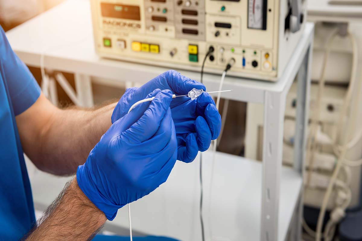 What is Radio Frequency Ablation?